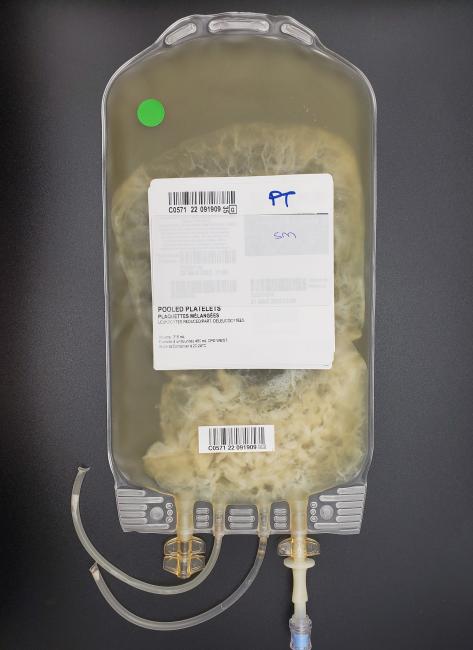 Platelets Bacterial Contamination Professional Education